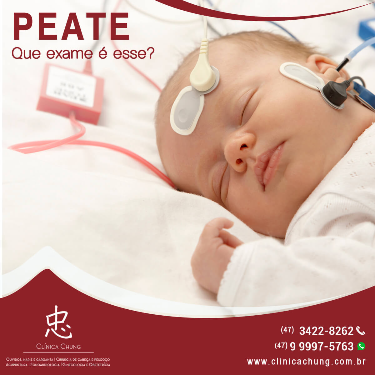 PEATE. Que Exame É Esse? - Clínica Chung Dicas